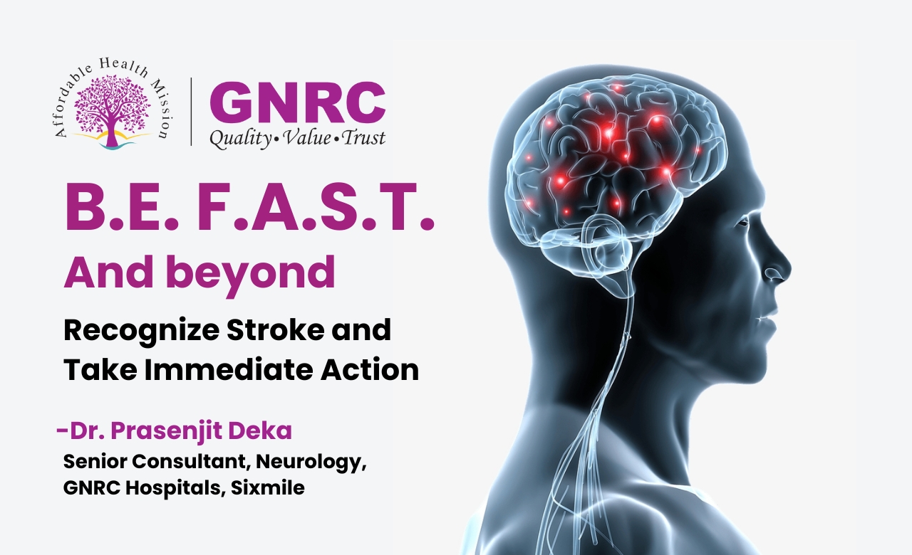 B.E.F.A.S.T. to Recognize Stroke and Take Immediate Action